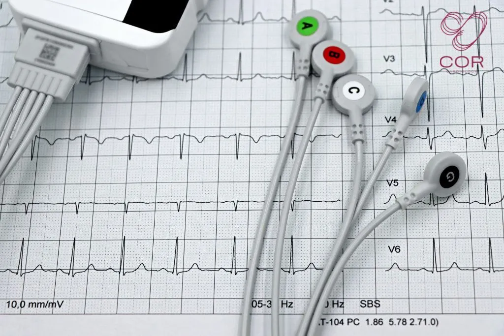 Electrocardiogram in Ormeau | Heart ECG Test in Ormeau – COR Cardiology
